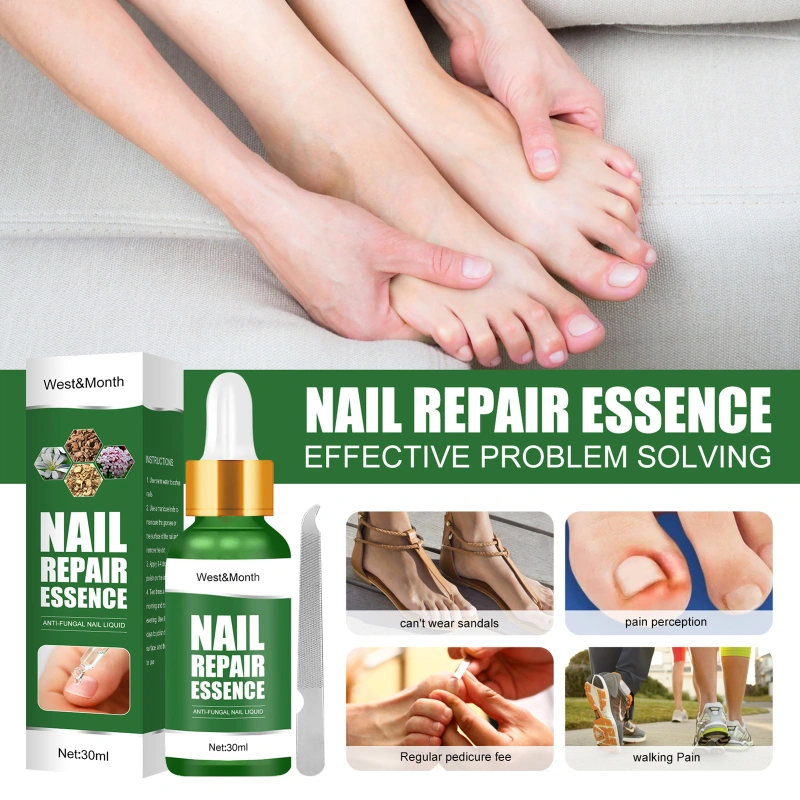 1 Set Nail Repair Liquid Fast Absorption Nourishing Mild Ingredients ...