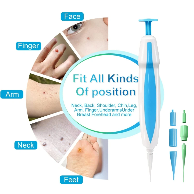 Remove Skin Tag Pen,Remove Skin Tag Pen Facial Care Nevus Tool 1mm-8mm ...